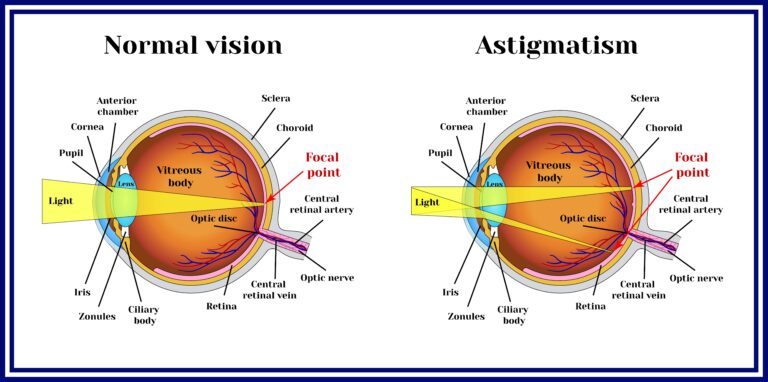 How Does Astigmatism Affect Vision? - Heffington's